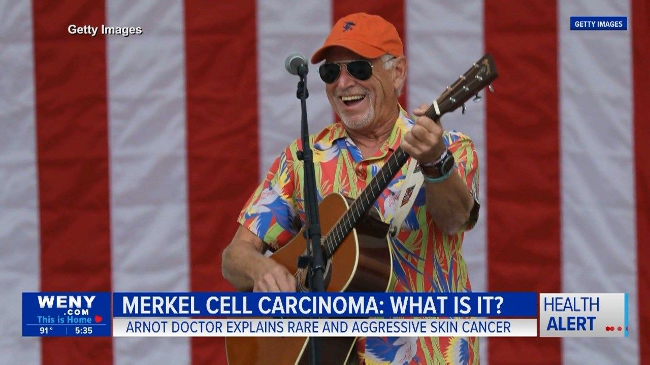 Merkel Cell Carcinoma: What is it? Arnot doctor explains rare and ...