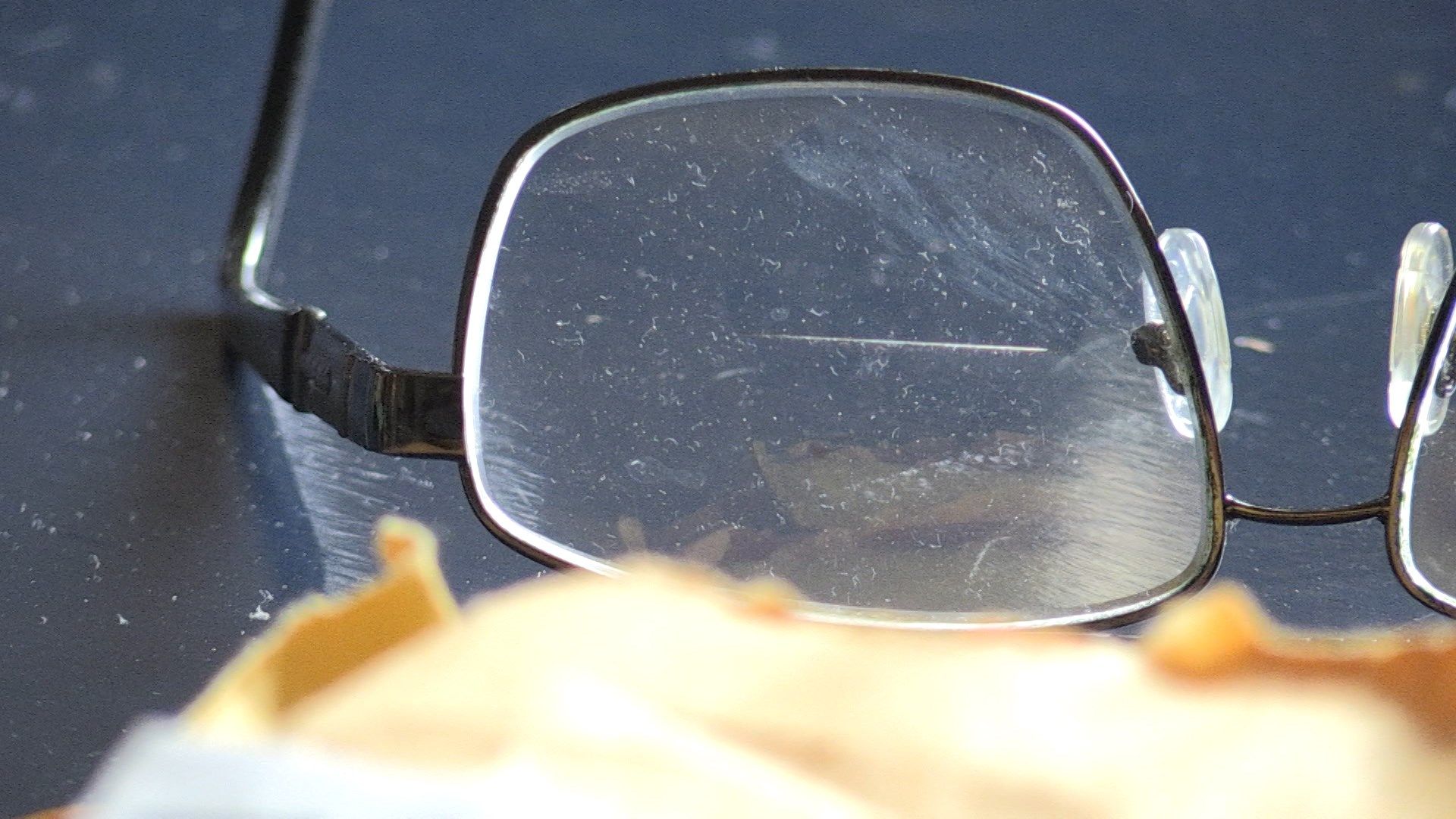 Losing hope: Corning Vet says eye surgery to improve vision made it ...